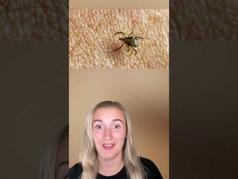 WHAT HAPPENS WHEN A TICK BITES YOU!😱