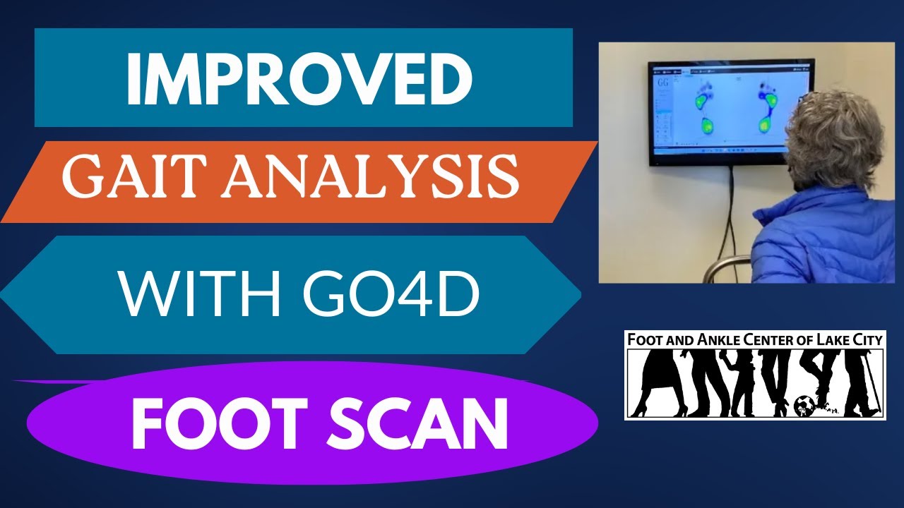 Improved Walking Analysis With Go4D Foot Scan | Foot and Ankle Center of Lake City