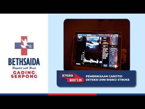 PEMERIKSAAN CAROTID, DETEKSI DINI RISIKO STROKE