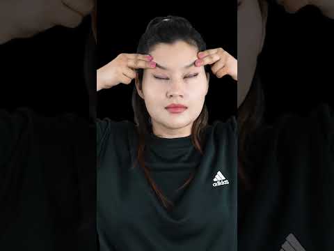 Fix Droopy Eyelids #shorts #youtubeshorts #droopyeyelids