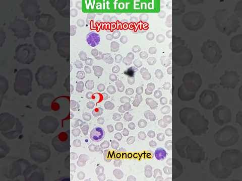 Rare Pics of WBC cells||amazing microscopic world 🌎 #bloodtest #microscope #shortsvideo