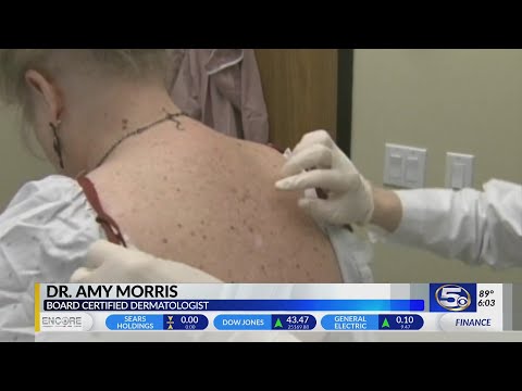 VIDEO: Melanoma--What is it, and who does it affect?