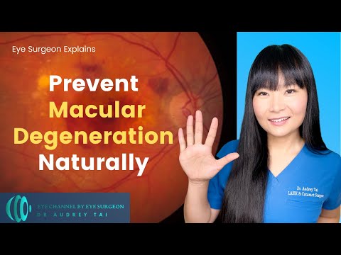 How to Prevent Macular Degeneration NATURALLY - 5 Tips | Eye Surgeon Explains #draudreytai