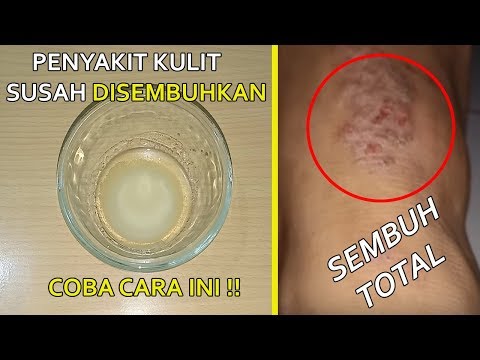 Obat Gatal Gatal & Penyakit Kulit Paling Ampuh 3 Hari Sembuh