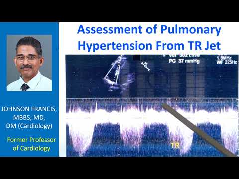 Assessment of Pulmonary Hypertension From TR Jet