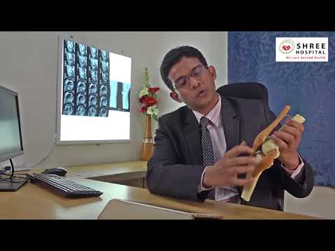 Arthroscopic Surgery Explained By Dr.Aniket Patil In Marathi