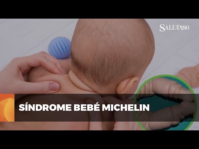 ¿Por qué se hunde la mollera de los bebés?