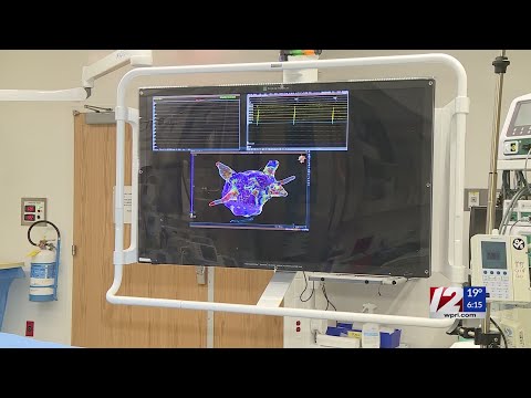 East Providence man first in world to undergo heart procedure part of new study