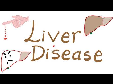 Liver Disease and Hemostasis Disorders