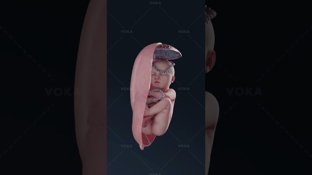 ¿Qué es la presentación podálica mixta y por qué se recomienda la cesárea? Obstetricia en 3D