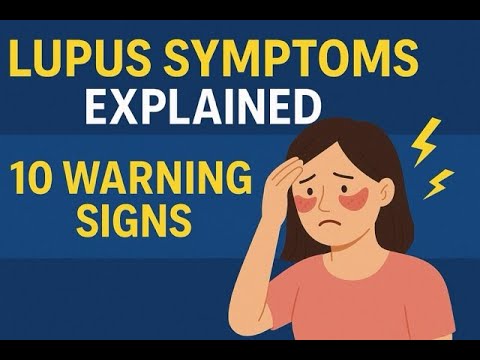 Lupus Symptoms Explained: 10 Warning Signs You Shouldn’t Ignore