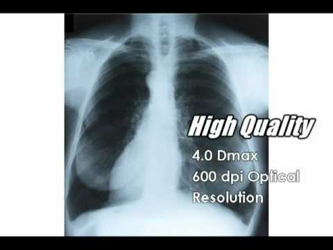 X Ray Film Digitizer - Digitizer Latest Price, Manufacturers & Suppliers