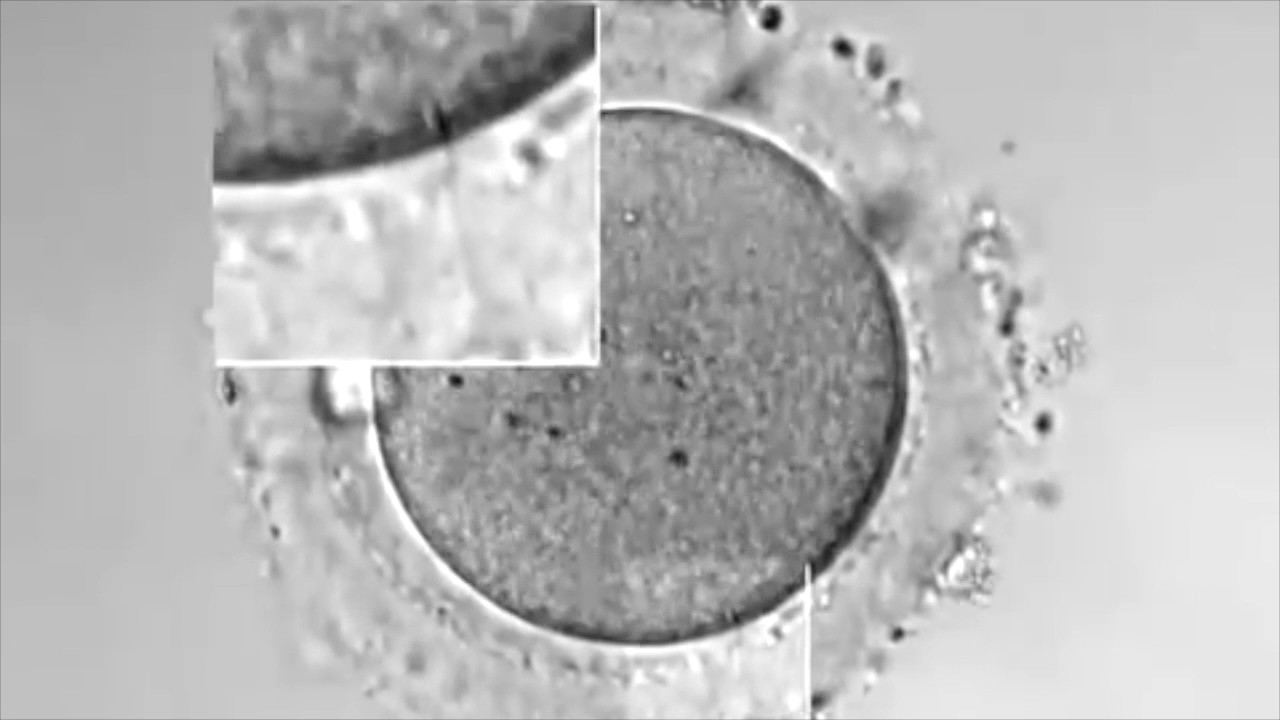 Fertilization - egg and sperm meeting during the  IVF process