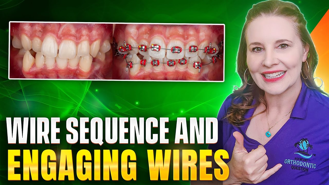 Wire Sequence and Engaging Wires