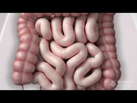 IBS Symptom relief using the FODMAP diet & Monash FODMAP app