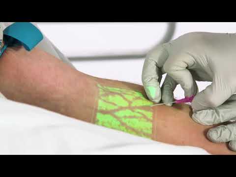 AccuVein AV500 Venipuncture Tip