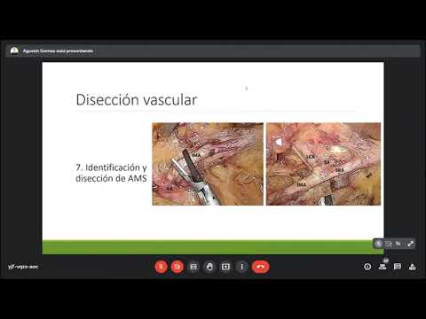 Colectomía Laparoscópica – Biología Médica