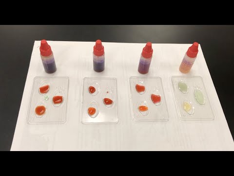 Blood Typing Lab Results Ms. Brown