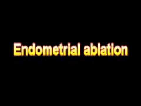 What Is The Definition Of Endometrial ablation - Medical Dictionary Free Online
