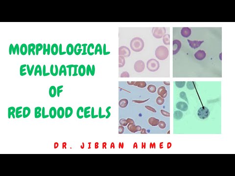 MORPHOLOGICAL EVALUATION OF RED BLOOD CELLS II PRACTICAL PATHOLOGY II @DR. JIBRAN AHMED