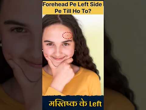 Forehead Pe Left side Pe Till hone ka matlab? #arunpandit #astrology #mole #samudrikashastra
