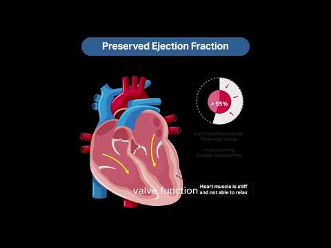 Echocardiogram 2-D echo