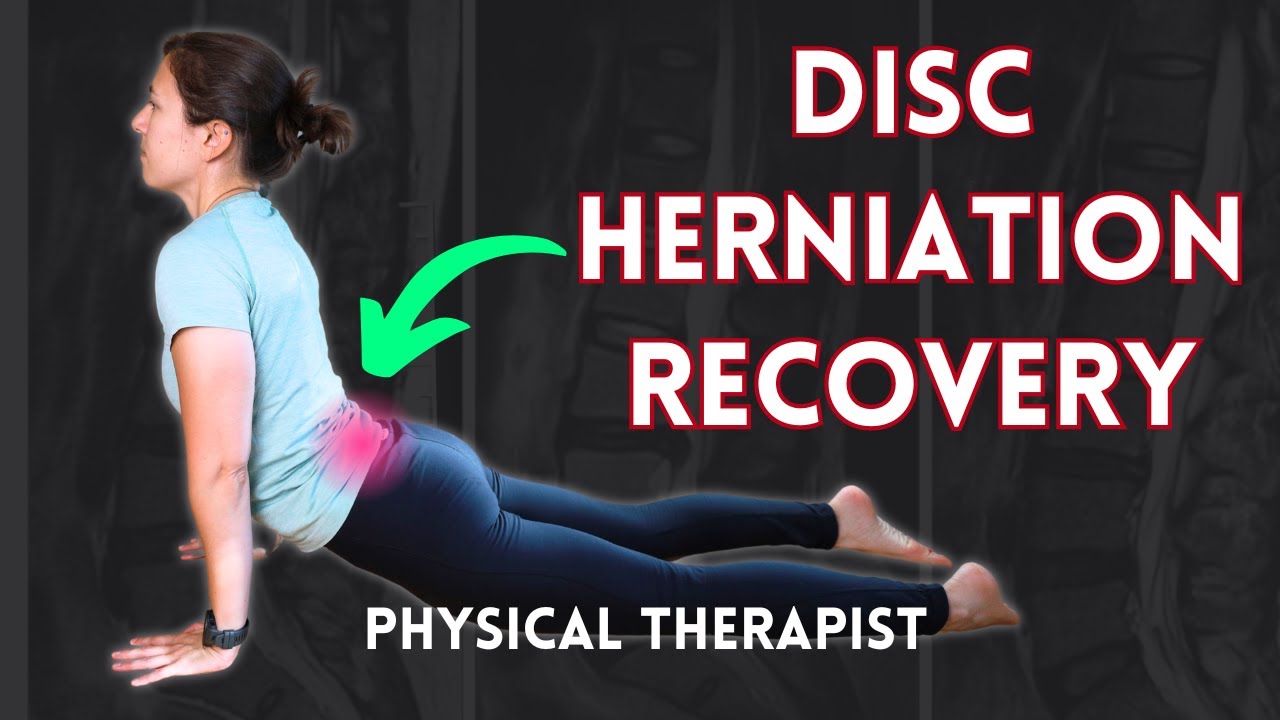 Top 5 Disc Herniation Exercises + Rehab Program