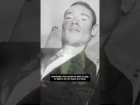 Man who spent 70 years in iron lung has died