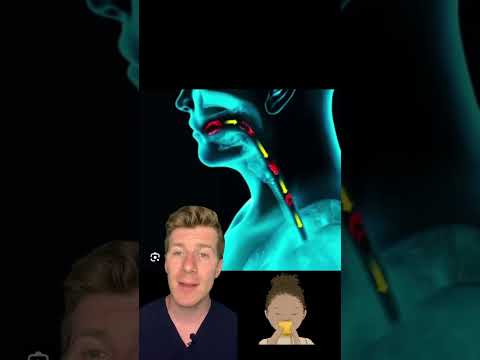 How singing can help Parkinson’s Disease… #health #doctor #shorts