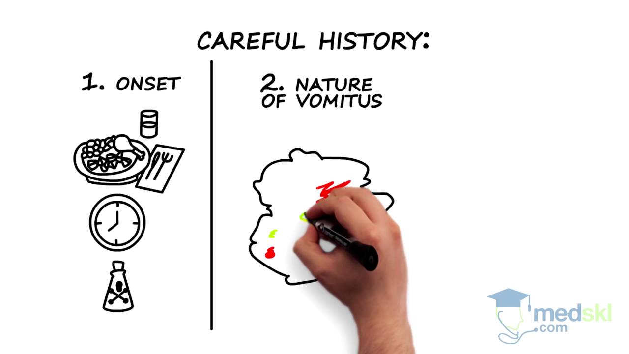 Gastroenterology - Nausea and Vomiting: By Eldon Shaffer M.D.