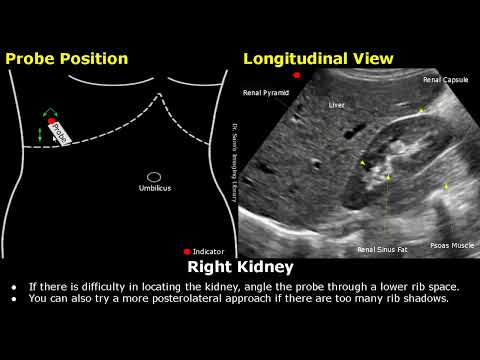 Kidney Ultrasound Probe Positioning | Transducer Placement & Scanning | Abdominal USG | Sonography