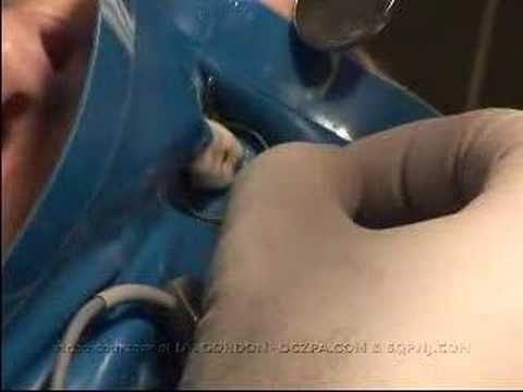 Media Root Canal Demonstration