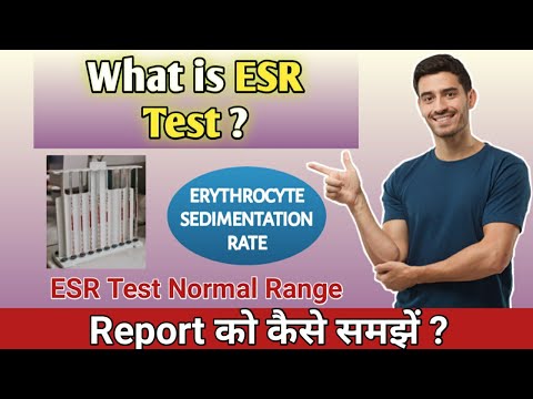 ESR Test in hindi | esr test procedure | esr means in hindi | erythrocyte sedimentation rate |