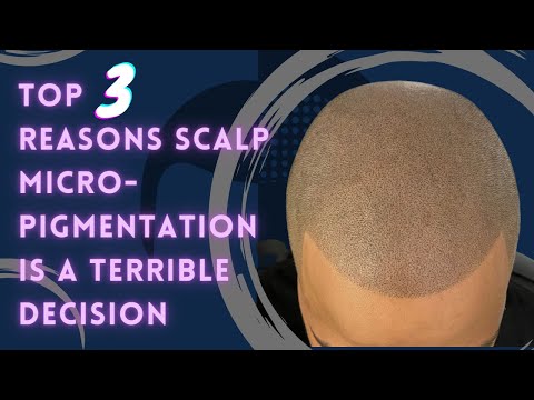 TOP 3 REASONS TO NOT GET #SCALPMICROPIGMENTATION | TOPLINESMP