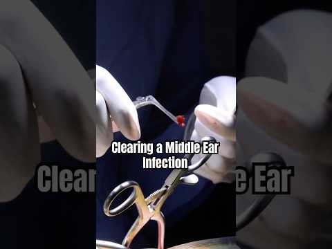 Ep. 25: Middle Ear Infection || #veterinarysurgery #vetmed #veterinary #pethospital #petcareprovider
