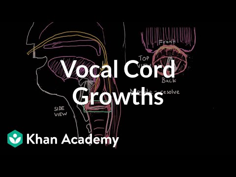 Vocal cord growths | Respiratory system diseases | NCLEX-RN | Khan Academy