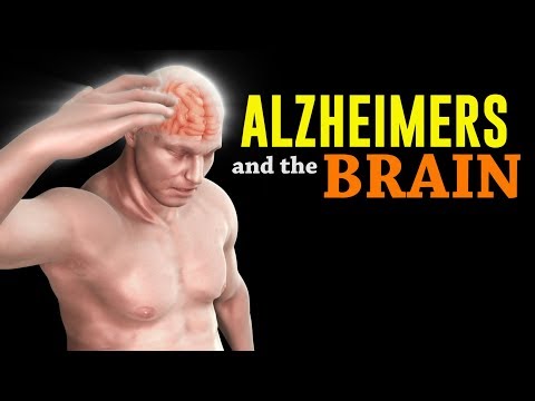 How Alzheimers Affects The Brain & The Body (The SCARY Facts)