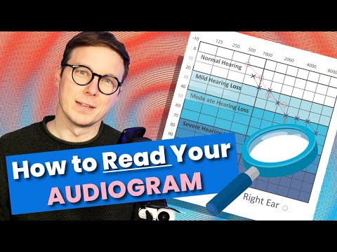 Understanding Your Audiogram: How to Read a Hearing Test