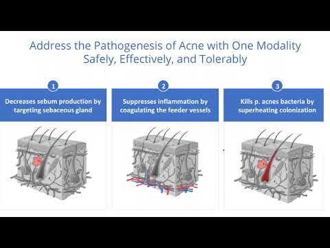 Acne & Psoriasis: Quicker Clearance with Better Patient Outcomes presented by Mark Nestor, MD, PhD