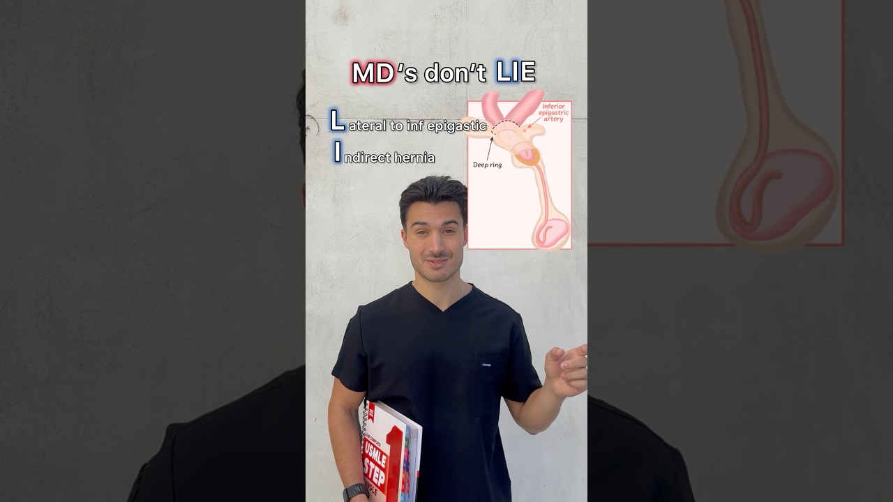 Easy trick for the Different Types of Hernias 🔻#medstudent #medschool #usmle #usmlestep1 #surgery