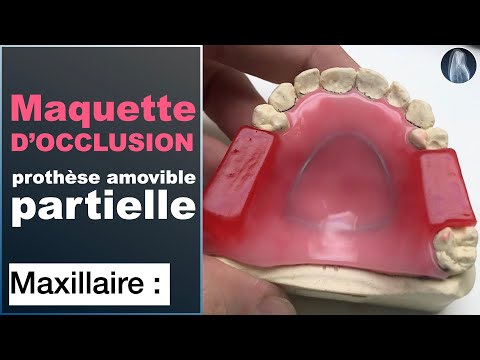 Fabriquez une Maquette d’occlusion pour Prothèse Amovible Partielle - Guide Complet Étape par Étape