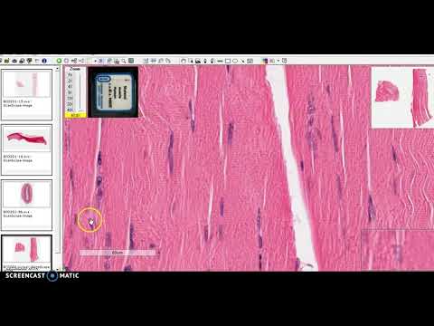 Dense Regular Connective Tissue