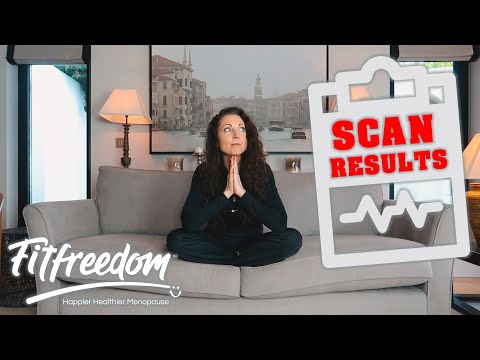 Bone Density Tests (why have a DEXA scan?) Menopause Shocker