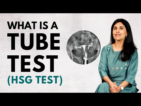 What is an HSG test (Tube Test ) | Infertility Series | Dr Anjali Kumar & Dr Prachi Benara | Maitri