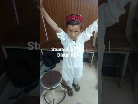 14 yr Old suffering from distal renal tubular acidosis | Stunted growth