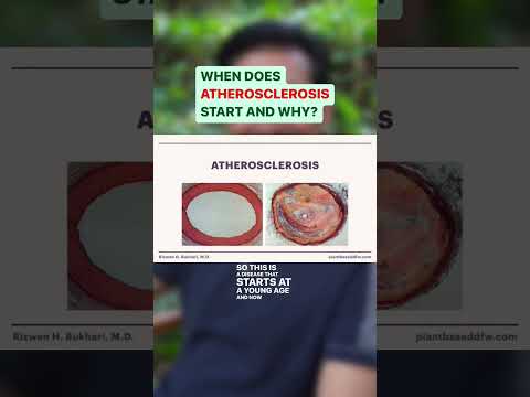 Understanding Atherosclerosis and Its Causes | Dr. Riz #shorts
