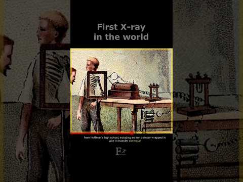 The first X-ray machine in the world #xray #history #oldest #facts