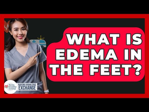 What Is Edema In The Feet? - Nursing Knowledge Exchange