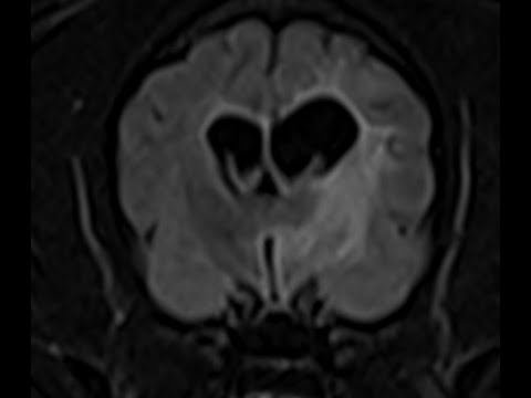 MRI Prognostic Factors in Dogs with Meningoencephalitis of Unknown Origin