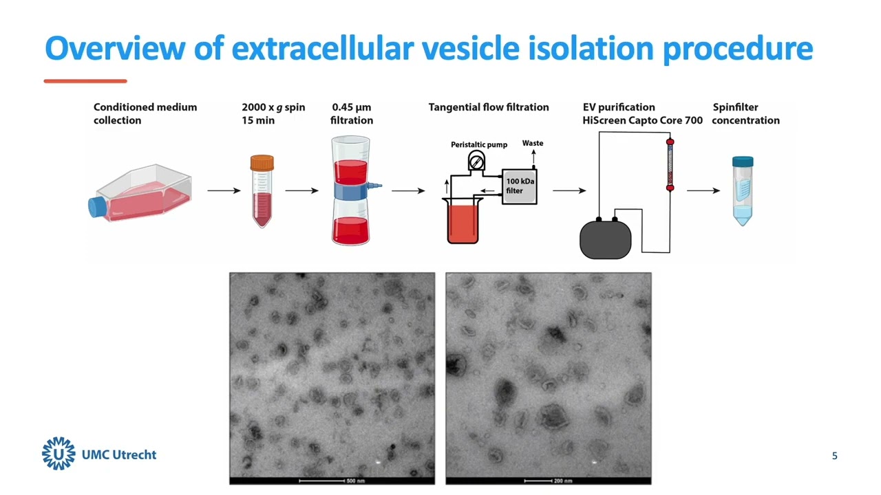 Optimizing extracellular vesicle recovery and function | UMC Utrecht